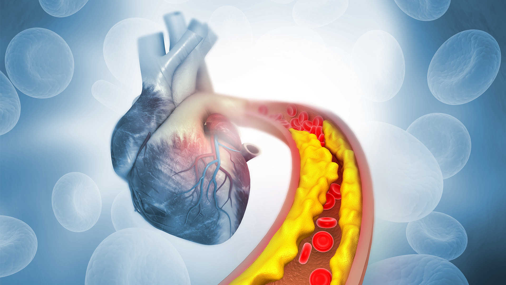 Kardiovaskularne bolesti